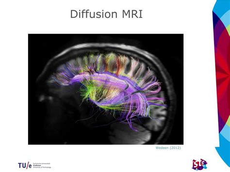 Ppt Finsler Geometry In Diffusion Mri Powerpoint Presentation Free Download Id