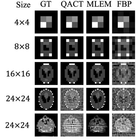 A Real Number Image Reconstruction Using 36 Projection Angles The Top