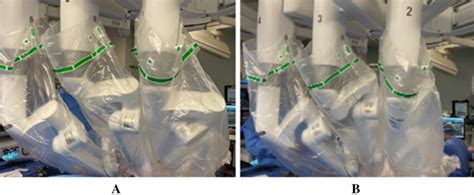 A Elbows Are Angled Acutely To Allow For Maximum Reach Deep Into The Download Scientific