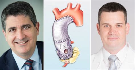 Valve Sparing Aortic Root Replacement Advantages And Outcomes