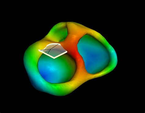 Catheter Precisions Vivo 3d Mapping System Secures Reimbursement In Nhs Englands Ssdp
