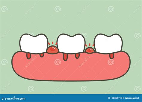 Problem Teeth With Crack Solid Icon Caries Infection Impacted Tooth