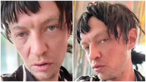 Preocupación Máxima Por El Estado De Salud De Camilo Blanes Tras Estas Extrañas Fotografías