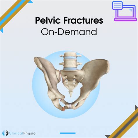 Pelvic Fractures On Demand Webinar Clinical Physio