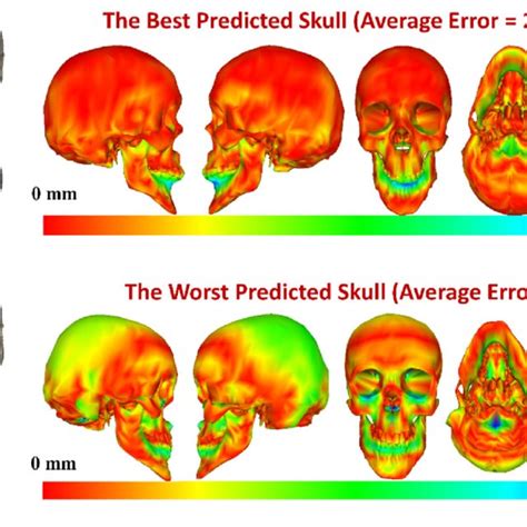 Segmentation And Surface Reconstruction Of The Head And Skull From Ct