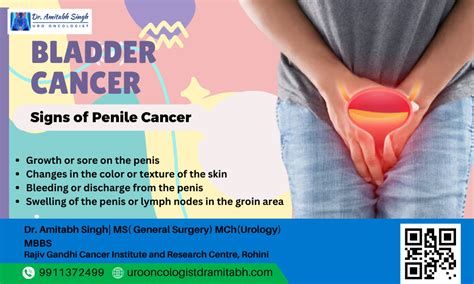 Signs Of Penile Cancer