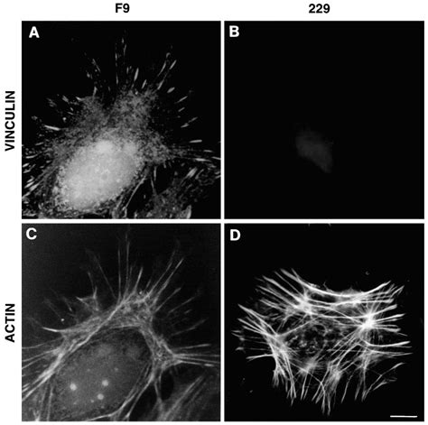 Stress Fiber Assembly In The Absence Of Vinculin F9 And Download