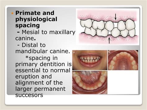 Self Correcting Anomalies Pptx