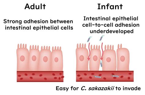 Understanding Cronobacter Sakazakii Risks Prevention And Safe