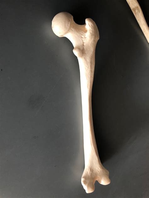 femur left [posterior] diagram quizlet
