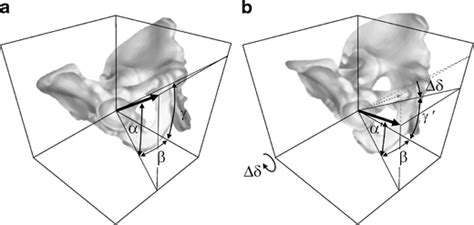 Estimation Of Pelvic Tilt On Anteroposterior X Rays—a Comparison Of Six Parameters Springerlink
