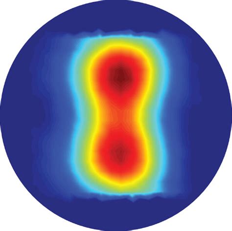 reconstructed tomographic images on fpga soc using lbp and ilbp