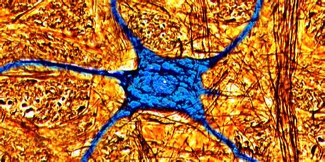 Researchers Track Individual Neurons As They Respond To Words Ars