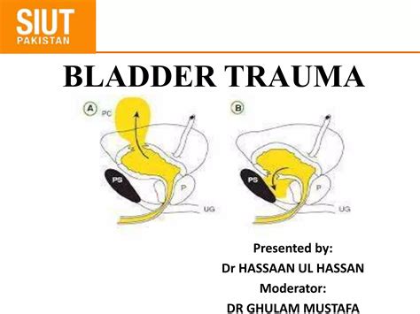 Bladder Trauma Ffpptx