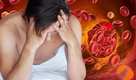 High Cholesterol Erectile Dysfunction Could Be A Sign While Statins A