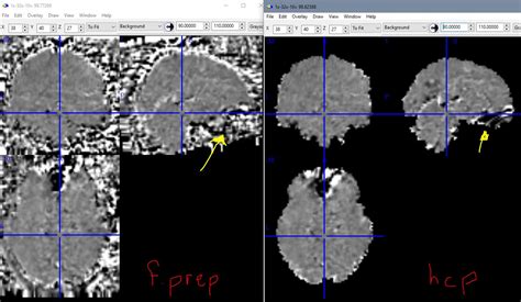 mvpa meanderings comparing fmriprep and hcp pipelines tsnr images