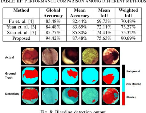 Table Iii From Effective Deep Learning For Semantic Segmentation Based Bleeding Zone Detection