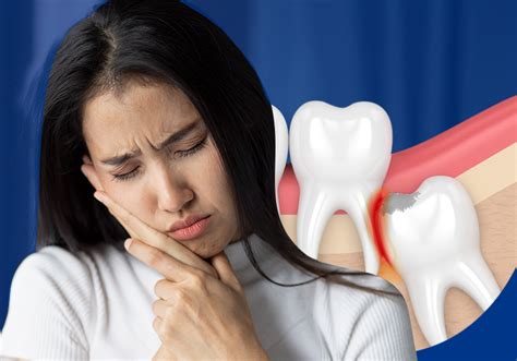 How Should I Handle A Decayed Wisdom Tooth Wassan Dental