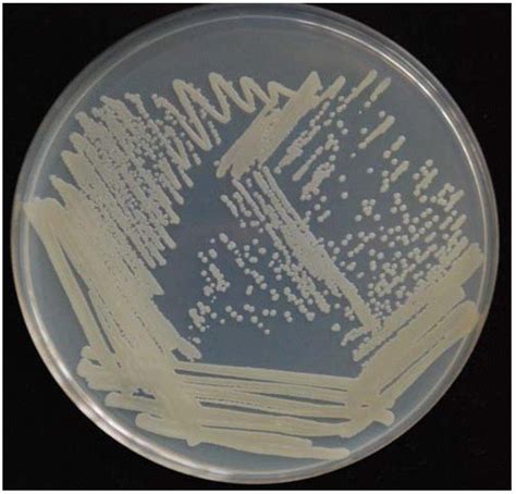 Bacillus Pumilus And Application Thereof Eureka Patsnap
