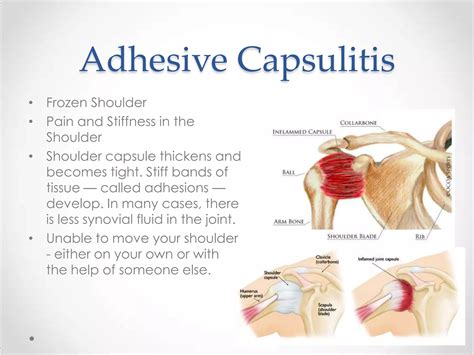 The Shoulder Joint Pptx