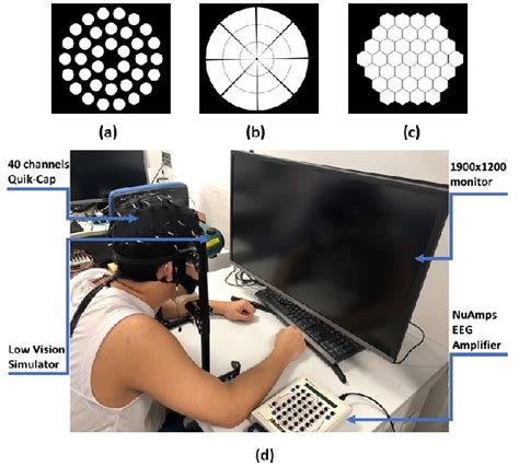 Figure 1 From Evaluation Of Steady State Visual Evoked Potentials