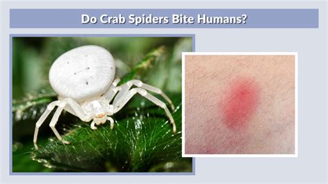 Crab Spider Bites Symptoms Safety And First Aid