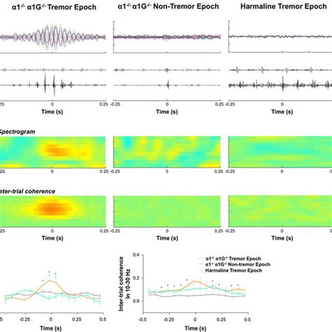 Comparison Of Tremor Related Activity Between Two Essential Tremor