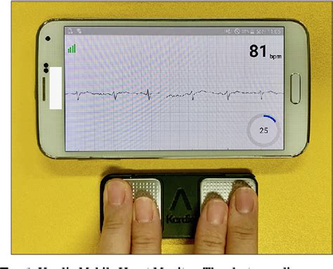Figure 1 From Screening For Atrial Fibrillation Using A Smartphone Based Electrocardiogram In