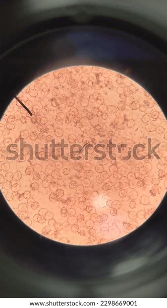 Hypertonic Solutions Photos And Images Shutterstock