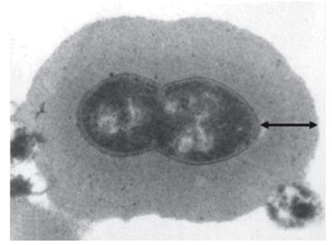 Microbiology Chapter 13 Pneumococcus And Bacterial Pneumonia Flashcards Quizlet