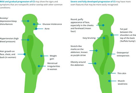 What To Know About Cushings Syndrome
