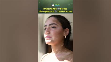 Importance Of Stress Management In Leukoderma Youtube
