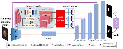 基于半监督算法的工业图像缺陷检测方法：memseg工业图像异常检测 Csdn博客