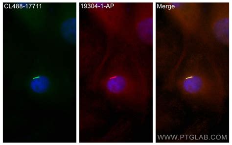 Ift122 Antibody 19304 1 Ap Proteintech