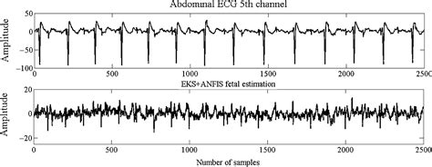 Extraction Of Fetal Electrocardiogram Ecg By Extended State Kalman Filtering And Adaptive