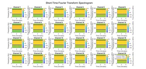 Getting Rid Of Extra Subplot Title After Using Spectrogram Function R