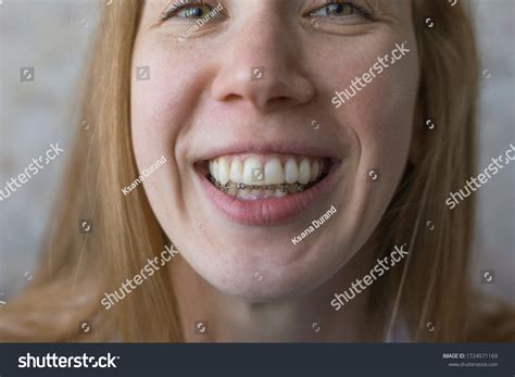 Cute Crooked Smile Girl