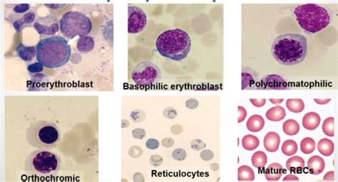 Proerythroblast Vs Basophilic Erythroblast