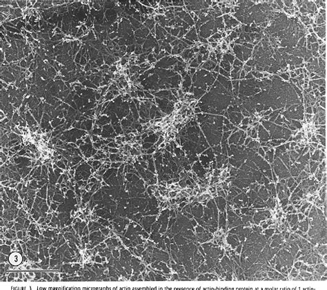 Figure 1 From Three Dimensional Structure Of Actin Filaments And Of An Actin Gel Made With Actin
