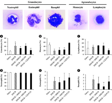 Eosinophil And Lymphocyte Differential Counts In Leukocyte