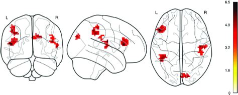 Group Level Result Of The Searchlight Decoding Analysis T Map Of