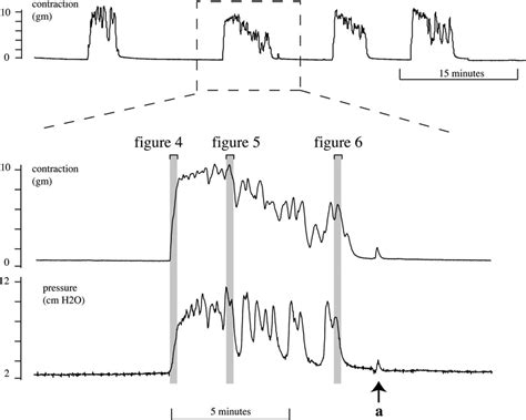 Top 4 Successive Contraction Events Recorded During 1 H The Second Download Scientific