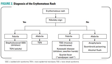 Medicalposts Squ On Twitter Diagnosis Of The Uknown Rash Simplified Algorithms To Find The