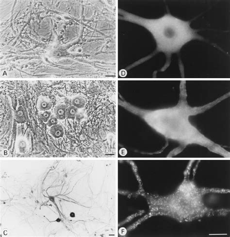 Sensory Neurons Microscope Sensory Neurons Microscope