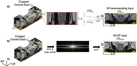 figure 2 from high resolution 3d mri with deep generative networks via