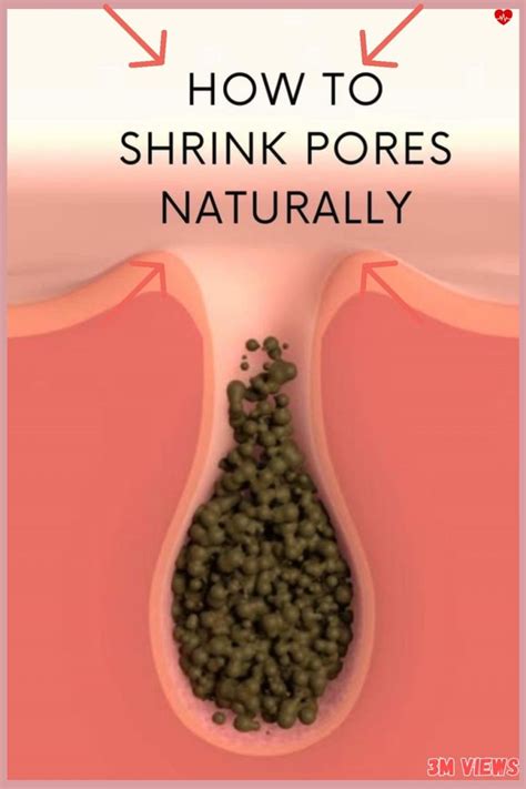 How To Shrink Enlarged Pores 5 Methods You Can Try Artofit