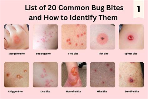 How To Identify Common Bug Bites That Could Harm Your Health The