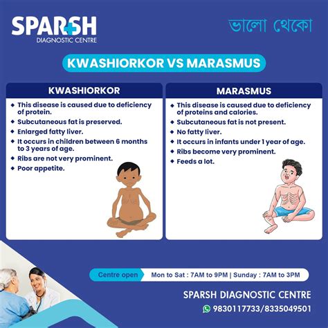 Difference Between Kwashiorkor And Marasmus A Complete Guide To