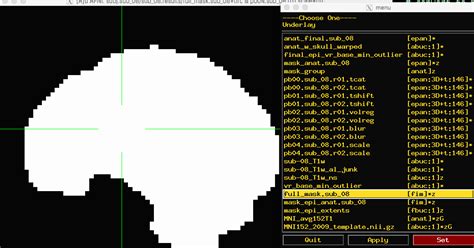 Chapter 7 Checking Preprocessing — Andys Brain Book 1 0 Documentation