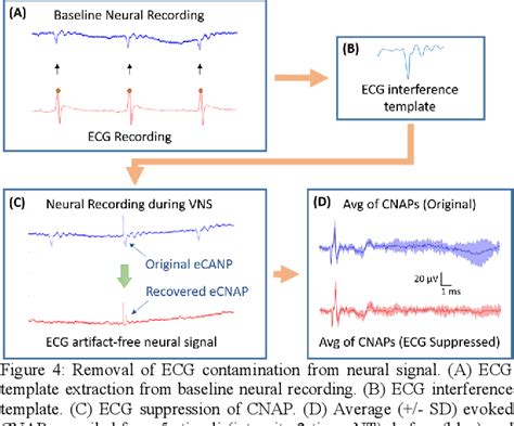 Figure 1 From Extraction Of Evoked Compound Nerve Action Potentials